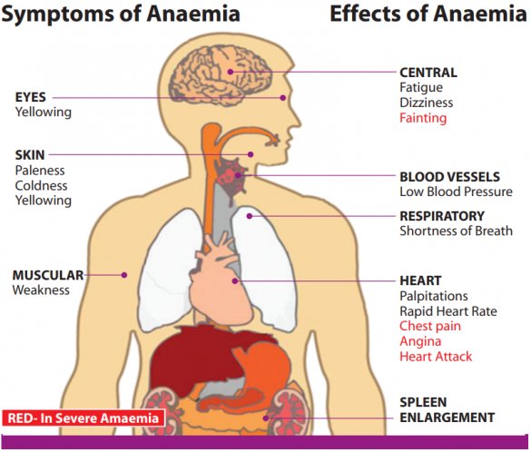 Anaemia An Invisible Malady - Best Multispeciality Hospital in Mumbai ...