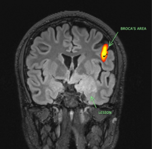 MRI in Neuroradiology – Beyond the static image At the forefront of MRI ...