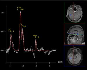 MRI in Neuroradiology – Beyond the static image At the forefront of MRI ...